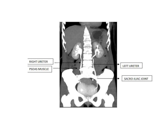 Kub anatomy | PPTX | Medical Health