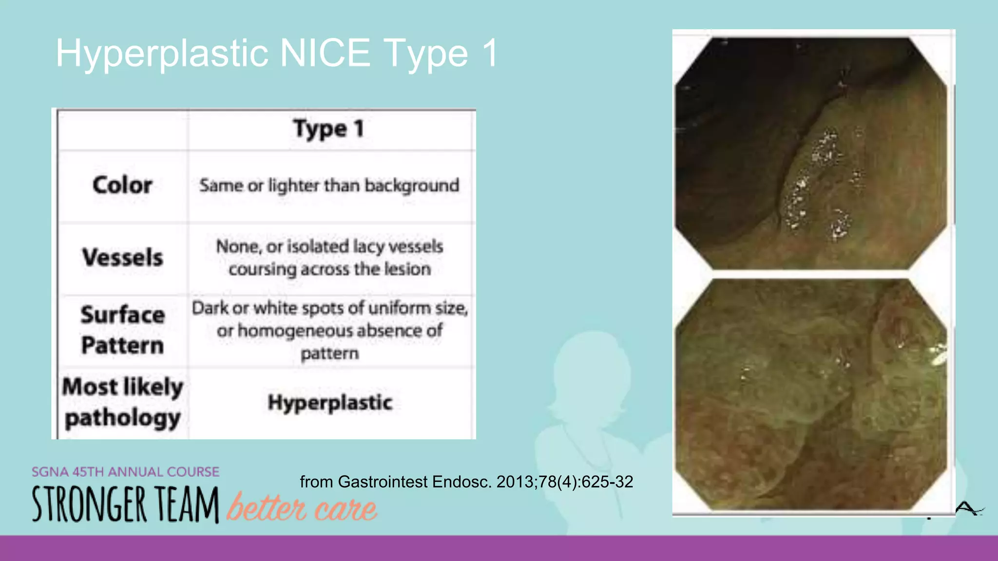 Kudos To You: Learning your Kudo Pit Patterns and Paris Polyp ...