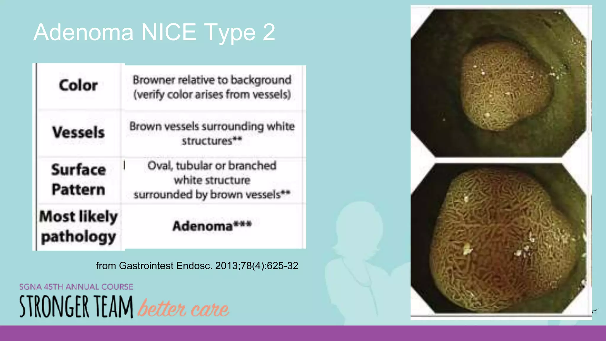 Kudos To You: Learning your Kudo Pit Patterns and Paris Polyp ...