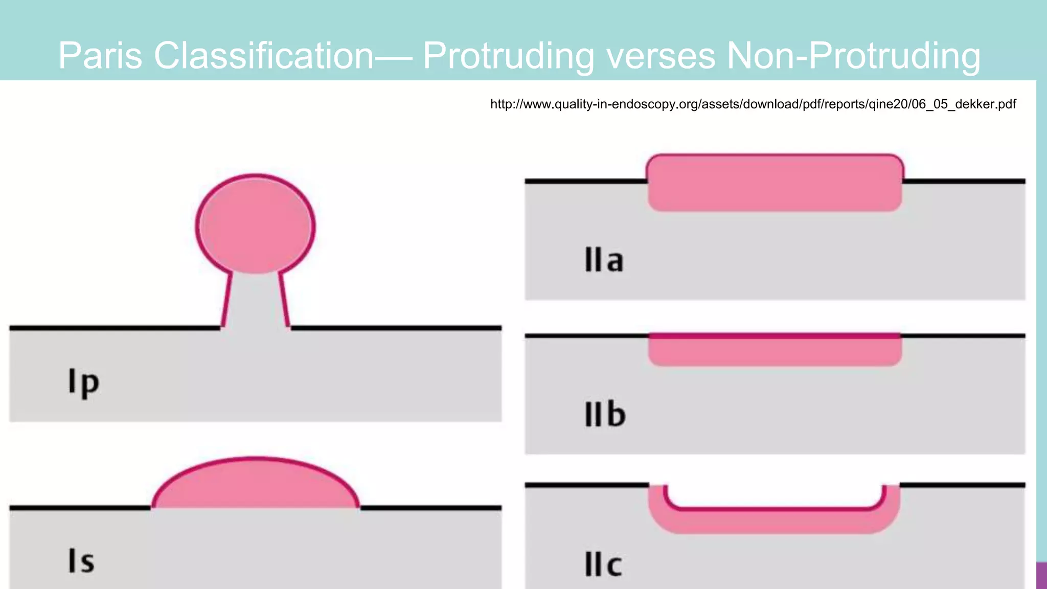 Kudos To You: Learning your Kudo Pit Patterns and Paris Polyp ...