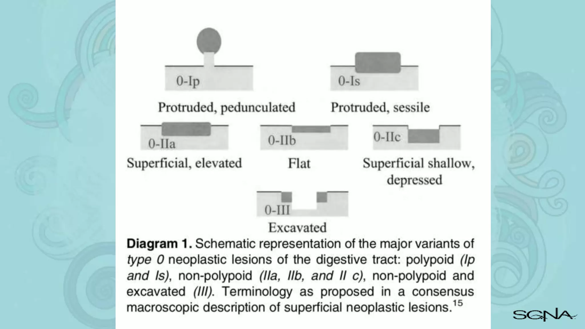 Kudos To You: Learning your Kudo Pit Patterns and Paris Polyp ...