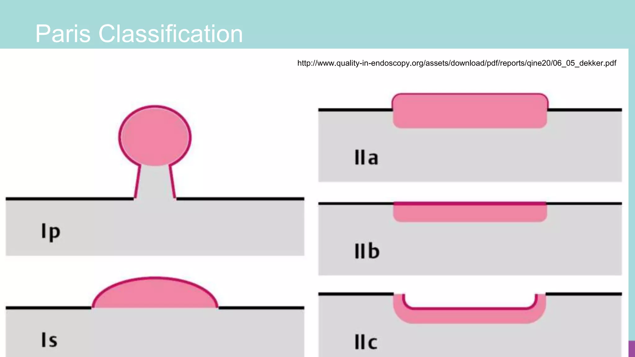 Kudos To You: Learning your Kudo Pit Patterns and Paris Polyp ...