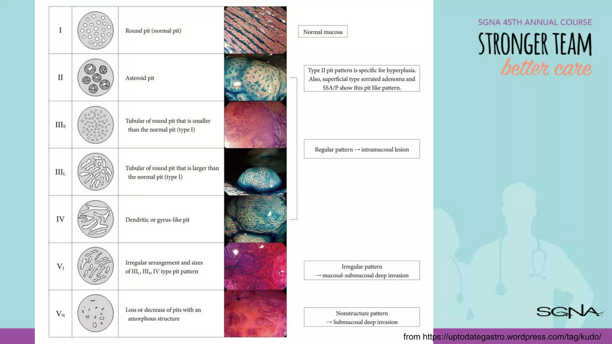 Kudos To You: Learning your Kudo Pit Patterns and Paris Polyp ...