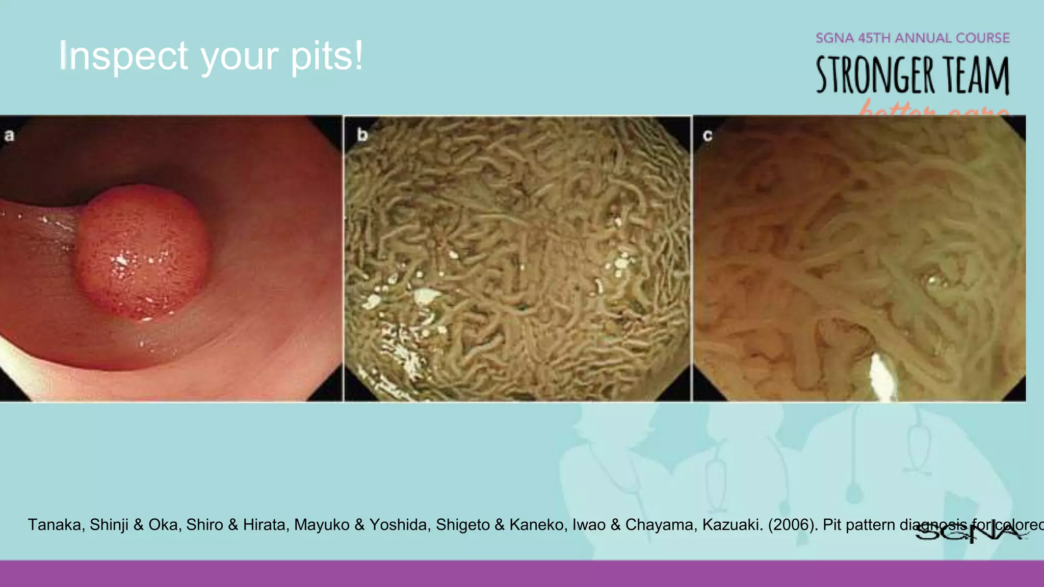 Kudos To You: Learning your Kudo Pit Patterns and Paris Polyp ...