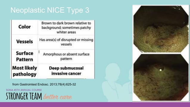 Kudos To You: Learning your Kudo Pit Patterns and Paris Polyp ...