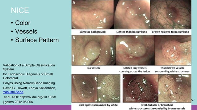 Kudos To You: Learning your Kudo Pit Patterns and Paris Polyp ...
