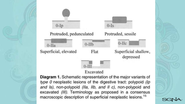 Kudos To You: Learning your Kudo Pit Patterns and Paris Polyp ...