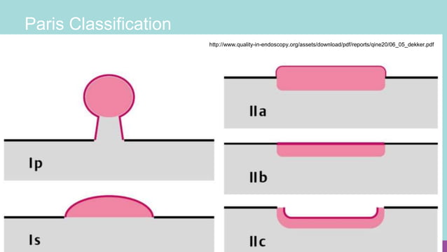 Kudos To You: Learning your Kudo Pit Patterns and Paris Polyp ...