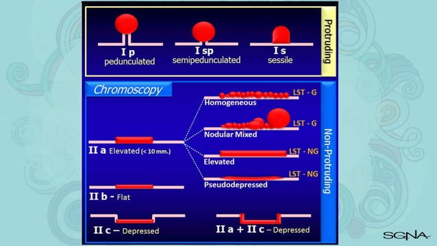 Kudos To You: Learning your Kudo Pit Patterns and Paris Polyp ...