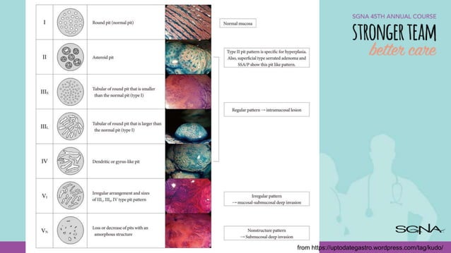 Kudos To You: Learning your Kudo Pit Patterns and Paris Polyp ...