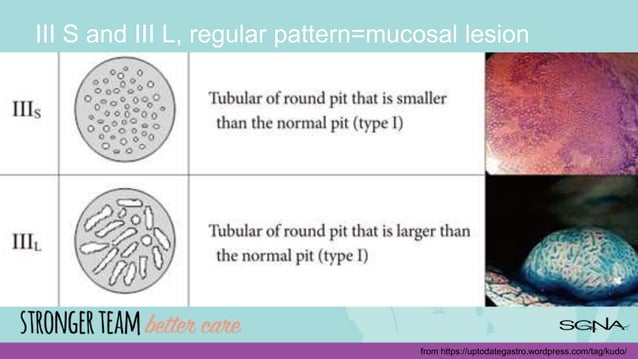 Kudos To You: Learning your Kudo Pit Patterns and Paris Polyp ...
