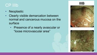 Kudos To You: Learning your Kudo Pit Patterns and Paris Polyp ...