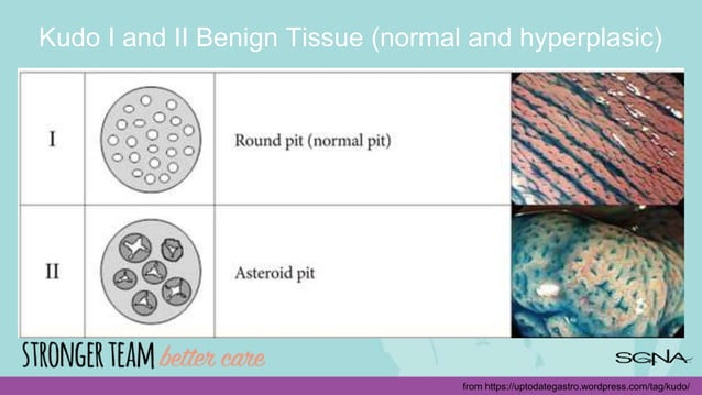 Kudos To You: Learning your Kudo Pit Patterns and Paris Polyp ...