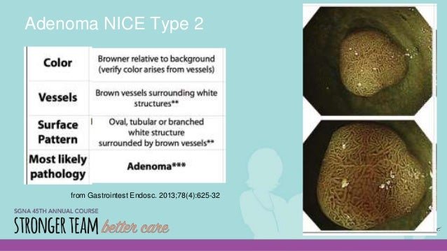 Kudos To You: Learning your Kudo Pit Patterns and Paris Polyp Classif…