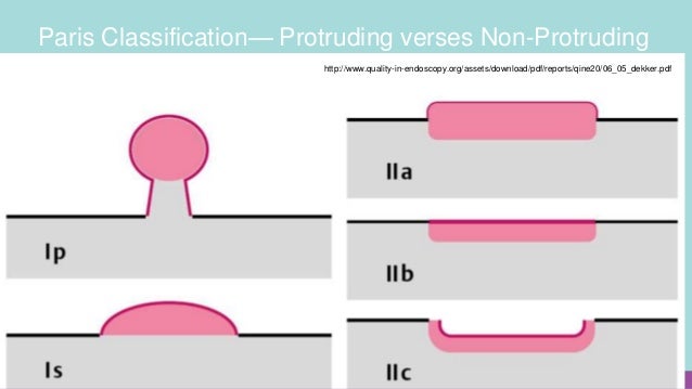 Kudos To You: Learning your Kudo Pit Patterns and Paris Polyp Classif…