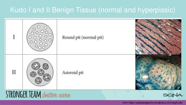 Kudos To You: Learning your Kudo Pit Patterns and Paris Polyp Classif…
