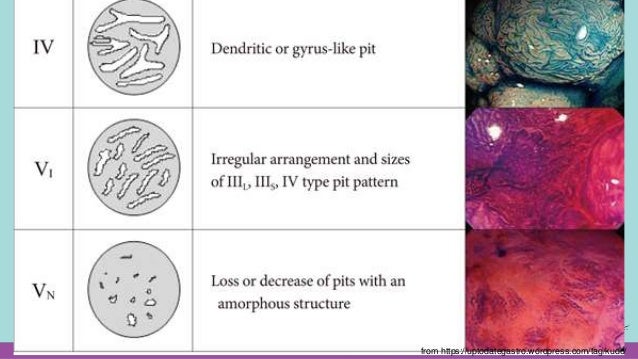 Kudos To You: Learning your Kudo Pit Patterns and Paris Polyp Classif…