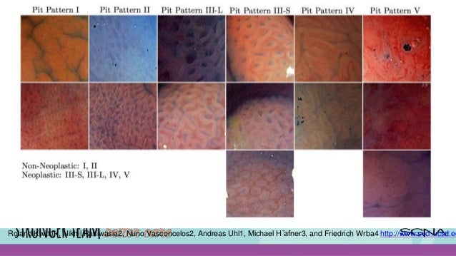 Kudos To You: Learning your Kudo Pit Patterns and Paris Polyp Classif…