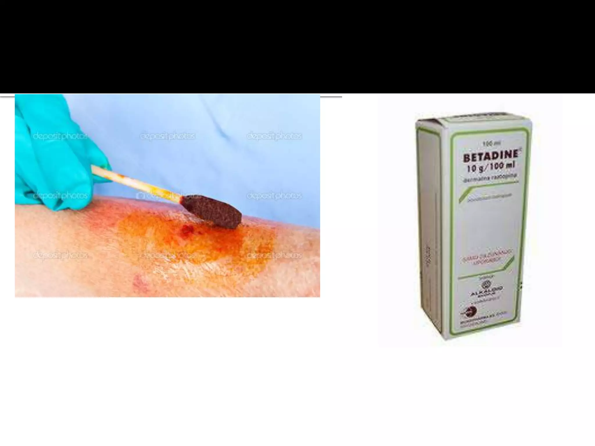 Kujdesi infermieror per plaget. | PPSX