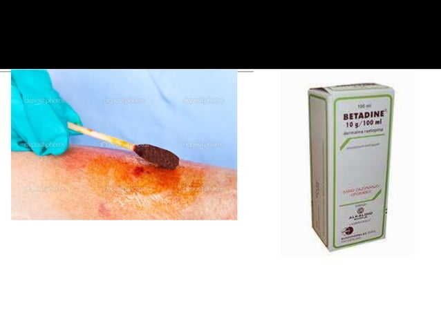 Kujdesi infermieror per plaget. | PPSX