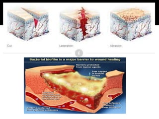 Kujdesi infermieror per plaget. | PPSX