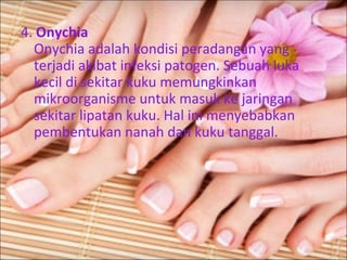 Kuku | PPT
