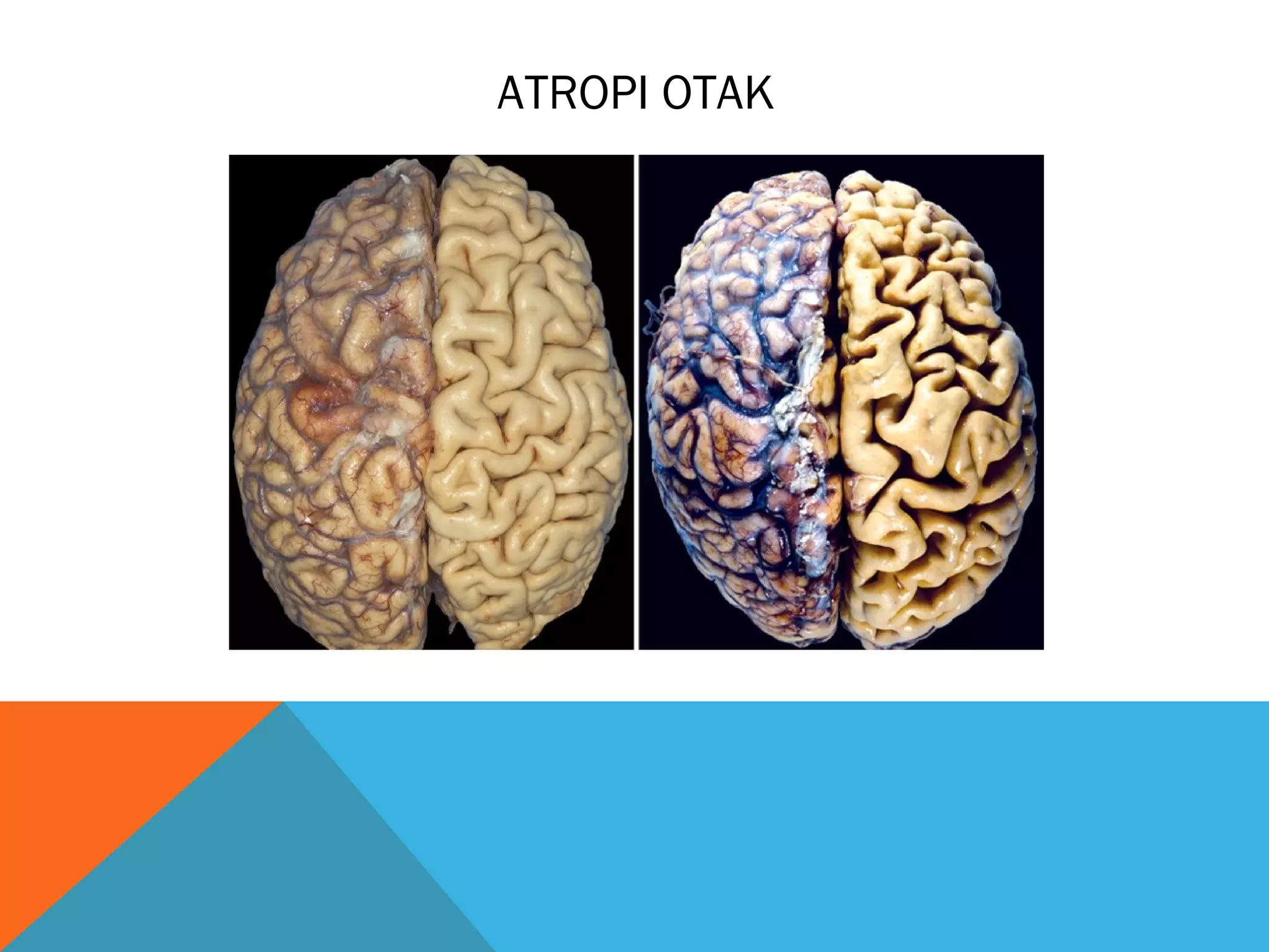 Kul 4. nekrosis dan kematian sel | PPT