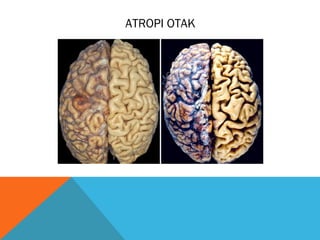 Kul 4. nekrosis dan kematian sel | PPT