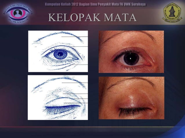 kuliah-1-anatomi-mata-orbita.ppt