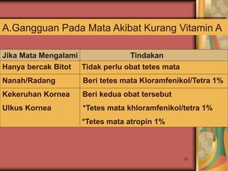 PENATALAKSANAAN-GIZI-BURUK-s.ppt