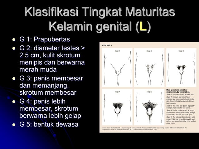 kuliah pubertas pada anak dan remaja h.ppt