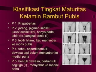 kuliah pubertas.ppt