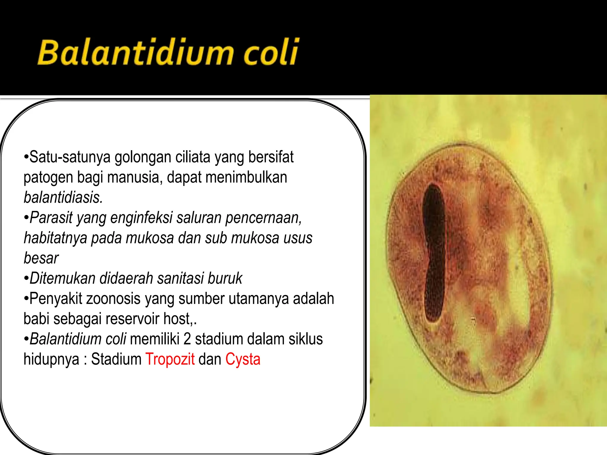 Kuliah 3 Cilliata Protozoa kelas ciliata.pptx