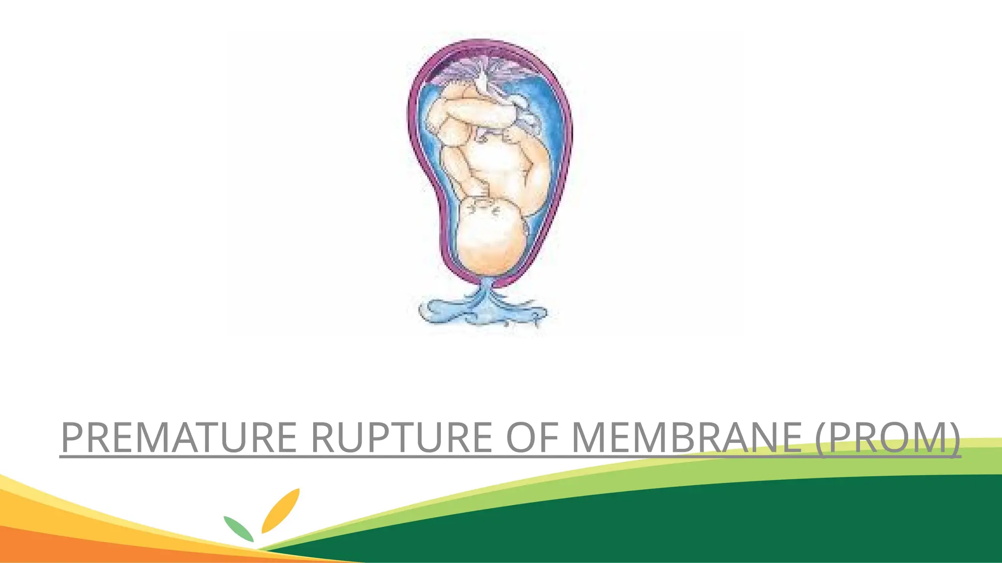 KULIAH BLOK 16 SISTEM REPRODUKSI_Premature Rupture of Membrane, Oligo ...