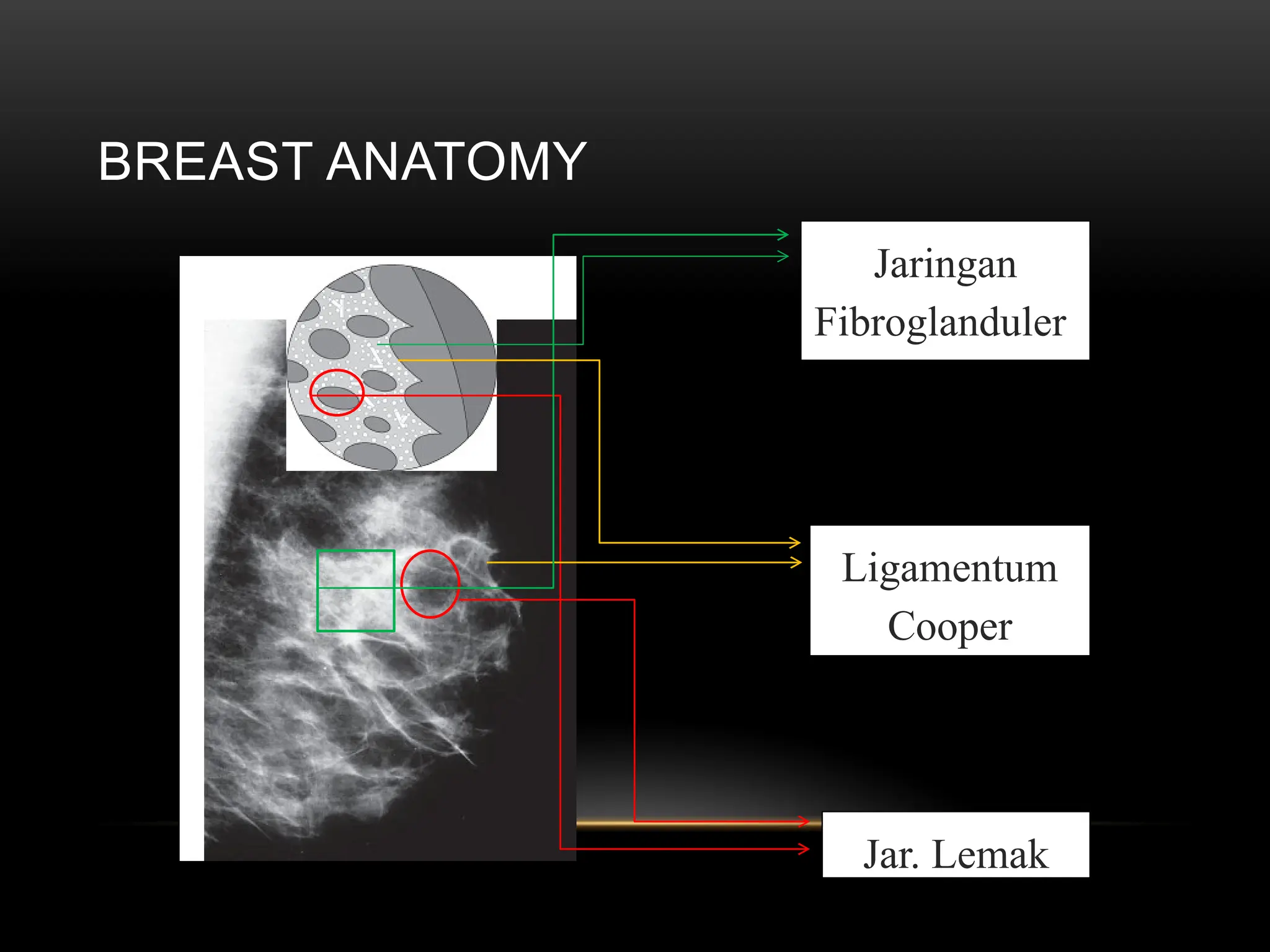 kuliah breast imaging s1 mammography ultrasound mri.pptx
