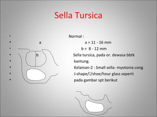 Kuliah neoro radiologi revisi | PPT