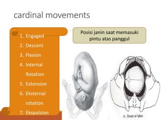 Kuliah penyegaran parturition, 7 cardinal movements, pelvimetri | PPTX