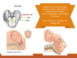 Kuliah penyegaran parturition, 7 cardinal movements, pelvimetri | PPTX
