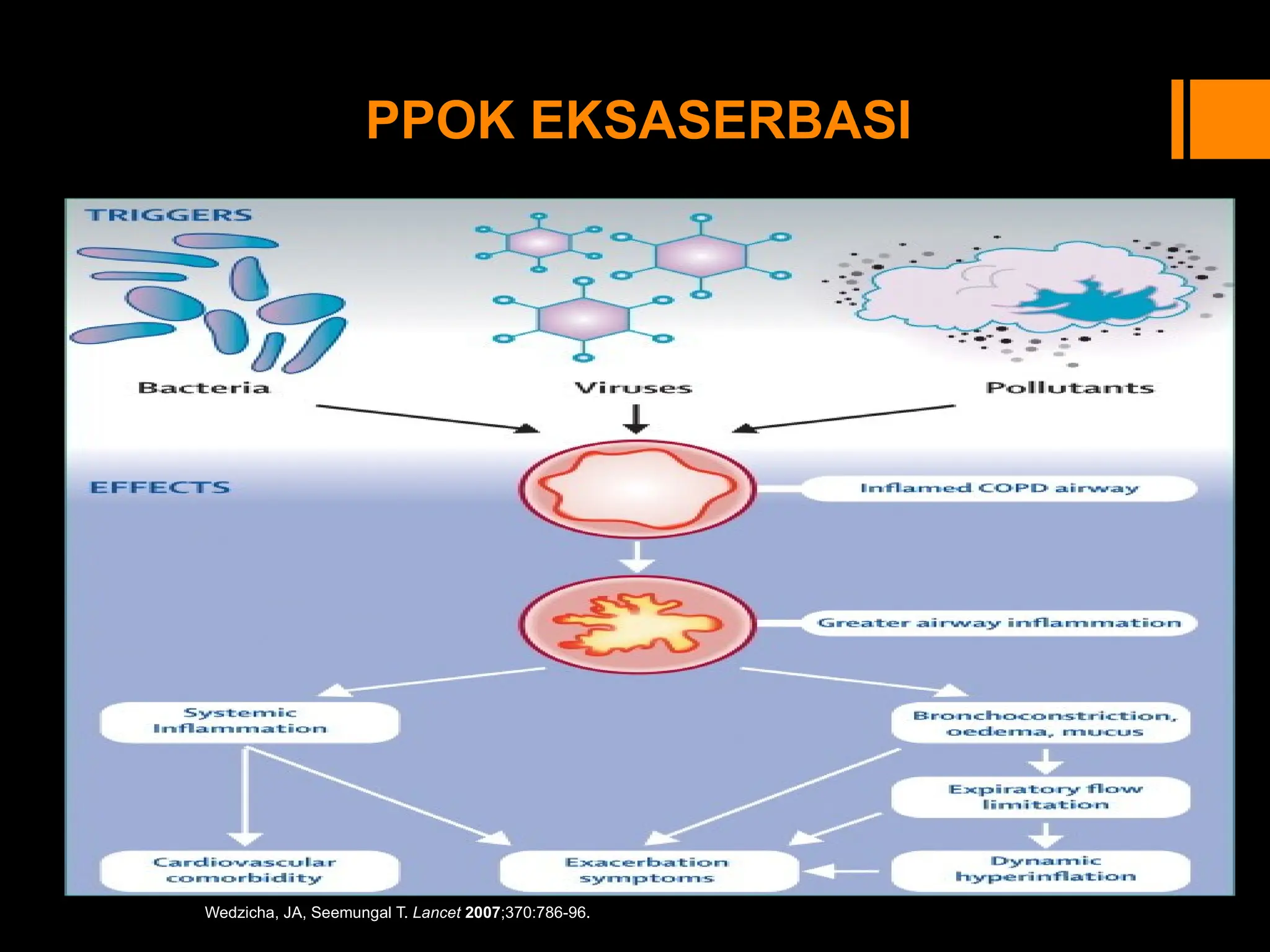 Penyakit Paru Obstruktif Kronik (PPOK).pptx