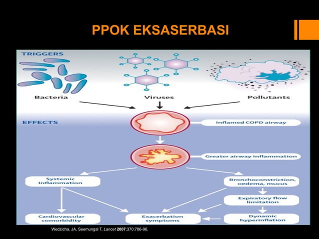Penyakit Paru Obstruktif Kronik (PPOK).pptx