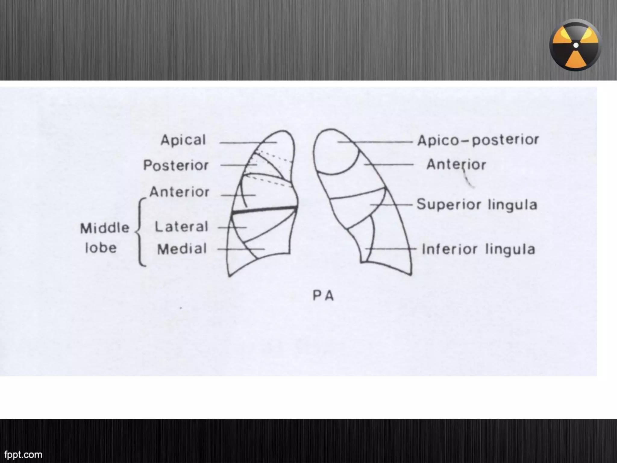 KULIAH RADIOGRAFI TORAKS NORMAL, blok 4.pdf