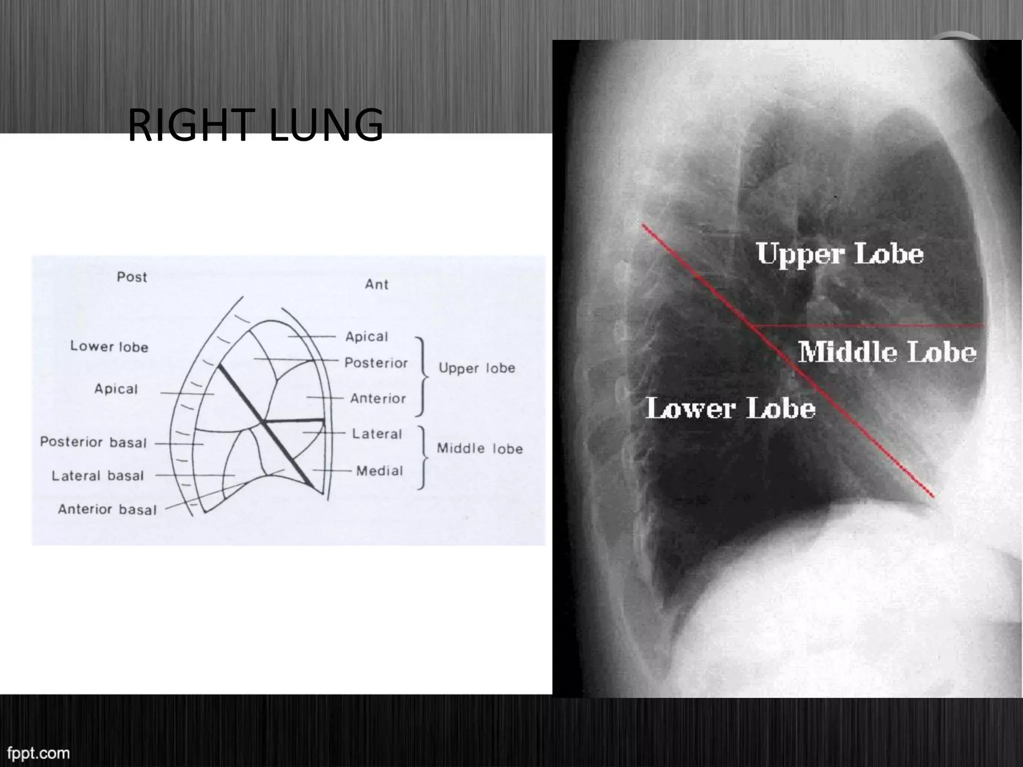KULIAH RADIOGRAFI TORAKS NORMAL, blok 4.pdf