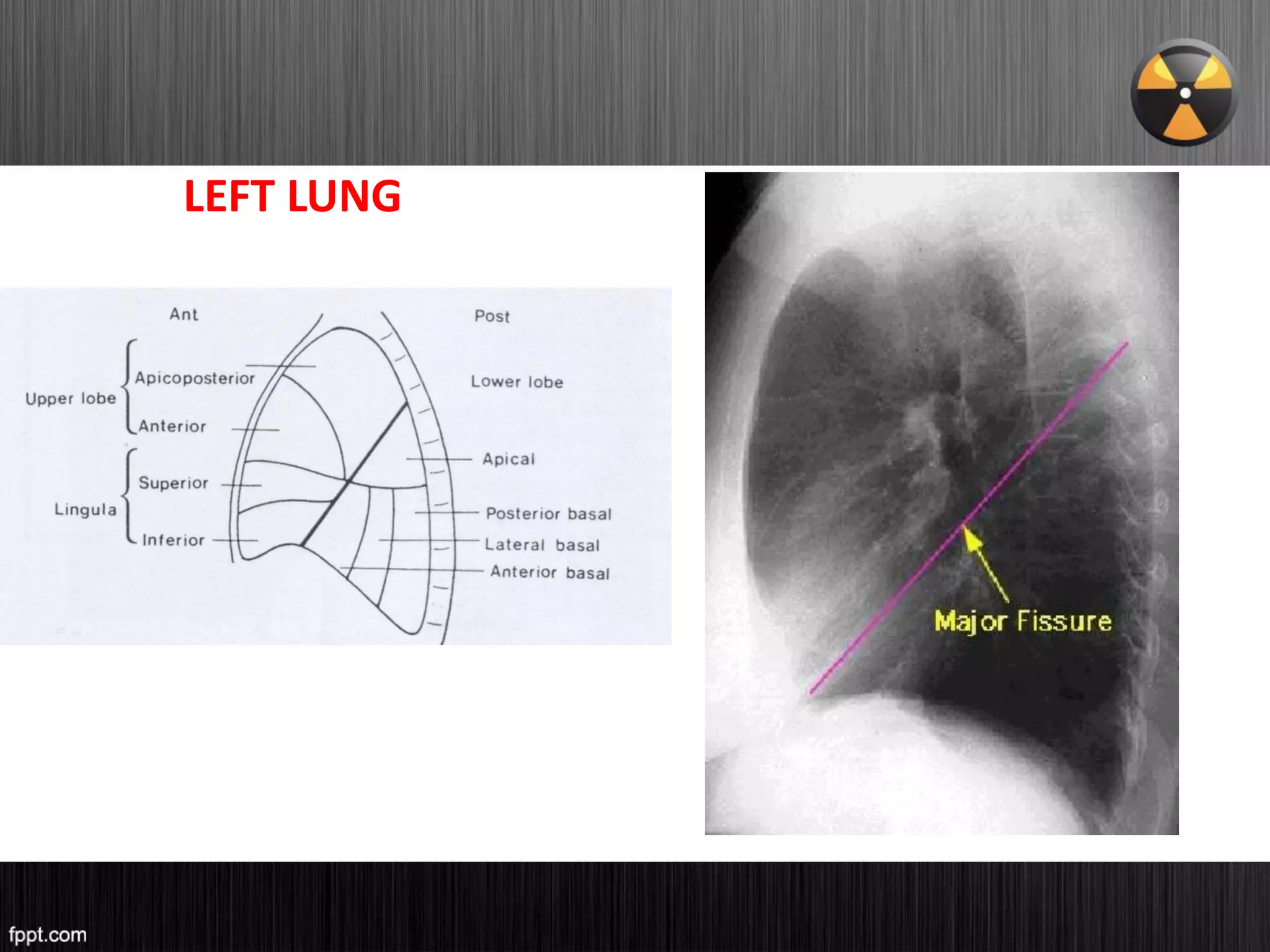 KULIAH RADIOGRAFI TORAKS NORMAL, blok 4.pdf