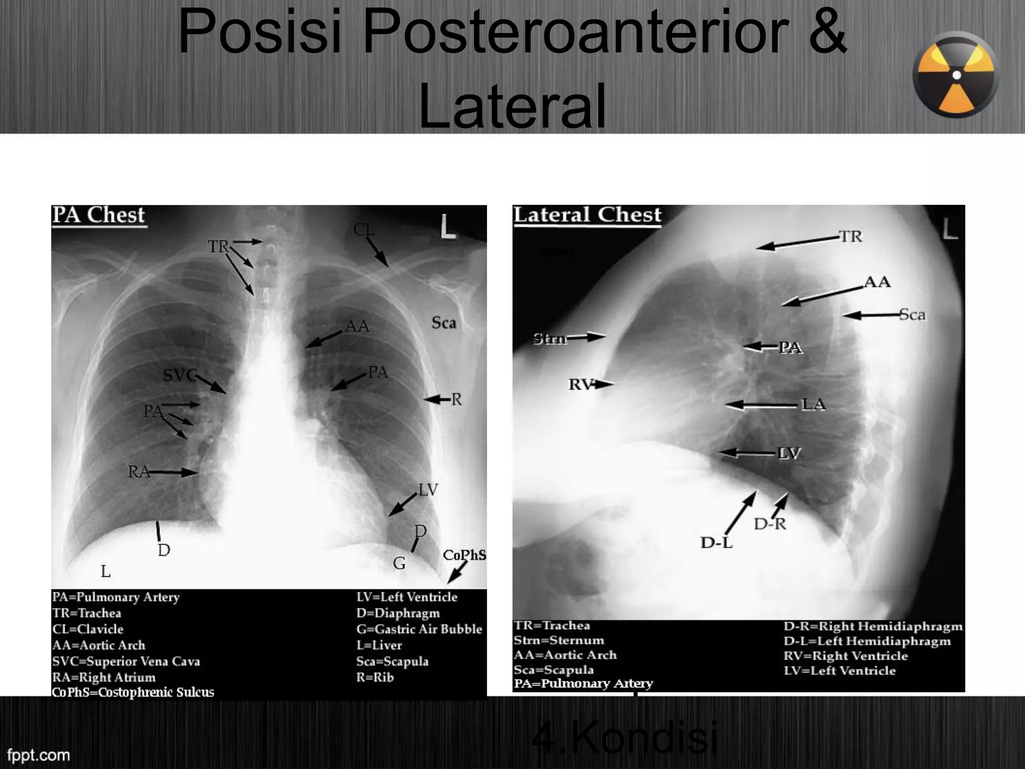 KULIAH RADIOGRAFI TORAKS NORMAL, blok 4.pdf