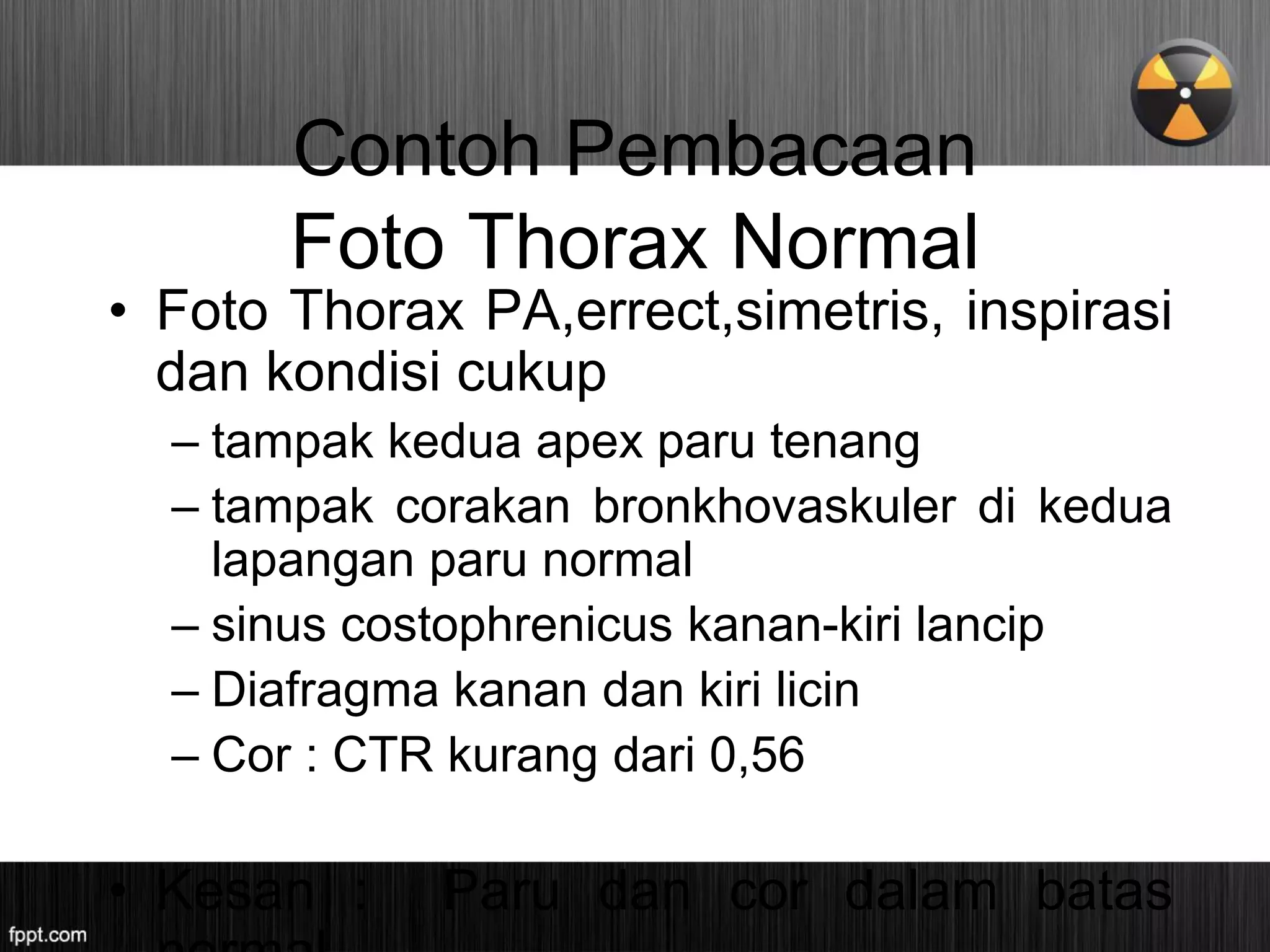 KULIAH RADIOGRAFI TORAKS NORMAL, blok 4.pdf
