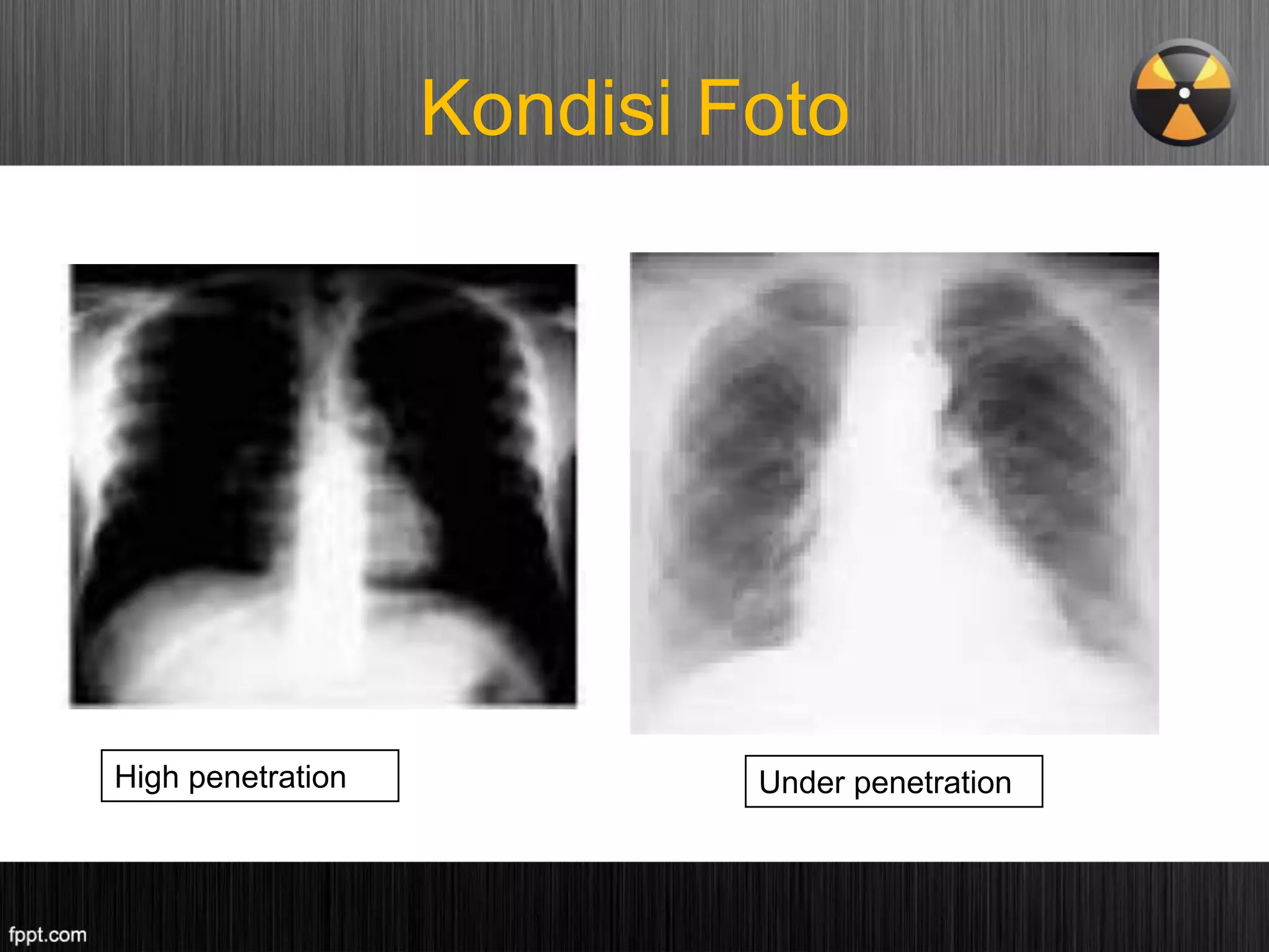 KULIAH RADIOGRAFI TORAKS NORMAL, blok 4.pdf