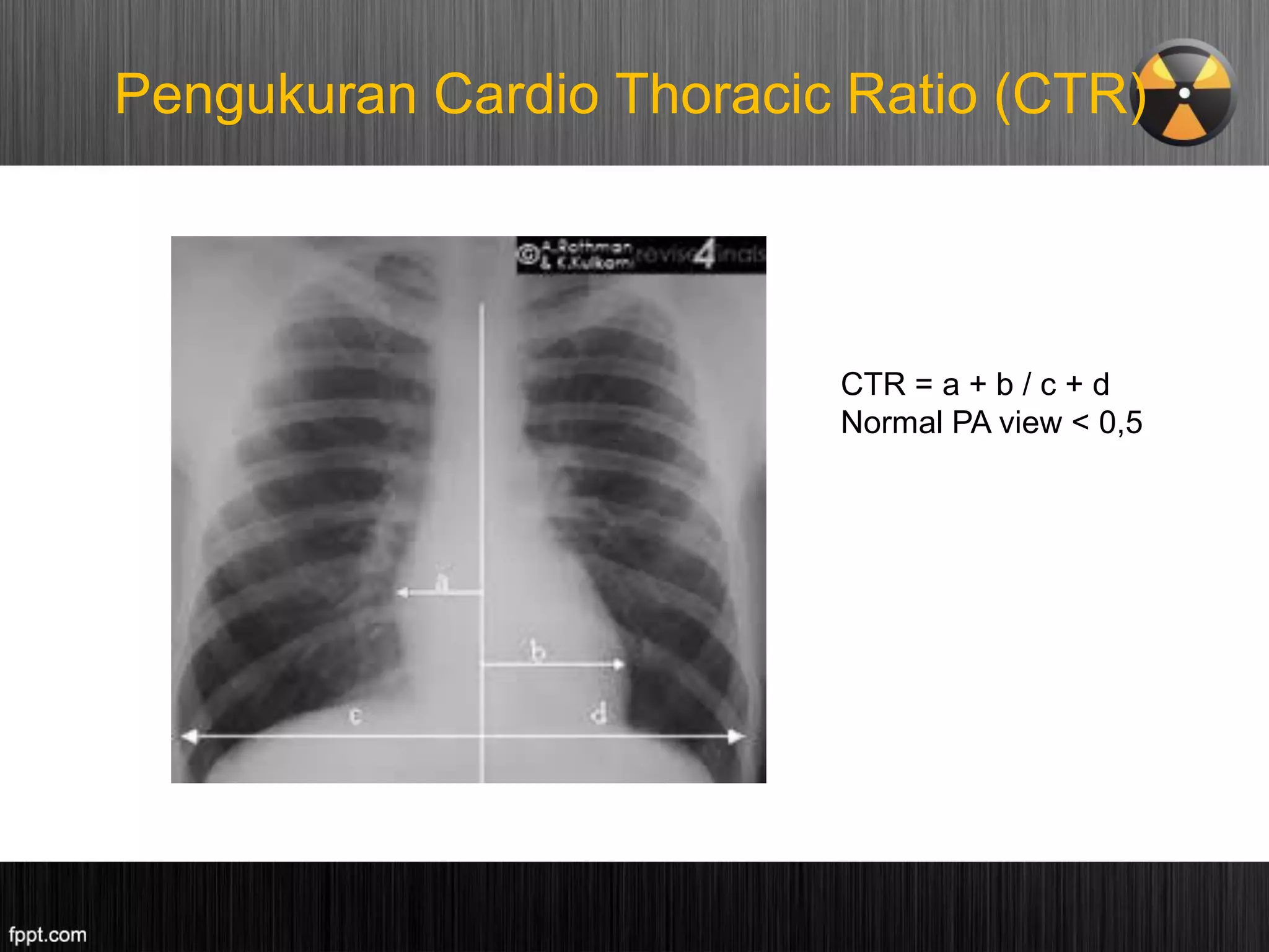 KULIAH RADIOGRAFI TORAKS NORMAL, blok 4.pdf