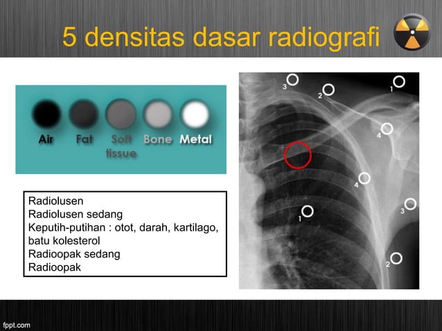 KULIAH RADIOGRAFI TORAKS NORMAL, blok 4.pdf