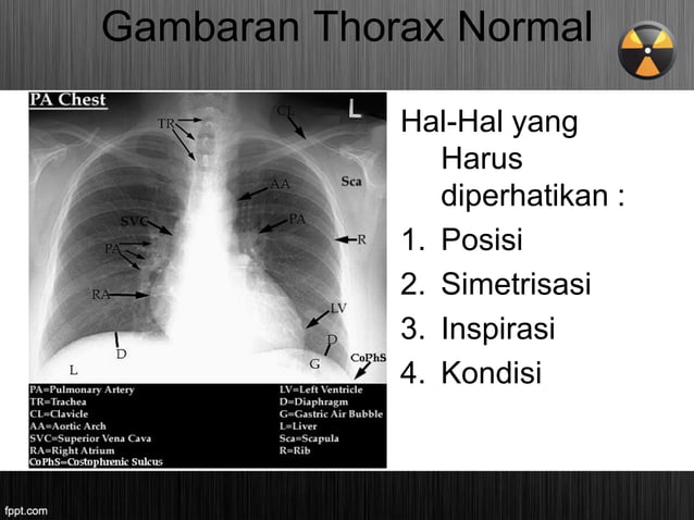 KULIAH RADIOGRAFI TORAKS NORMAL, blok 4.pdf