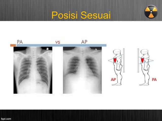 KULIAH RADIOGRAFI TORAKS NORMAL, blok 4.pdf